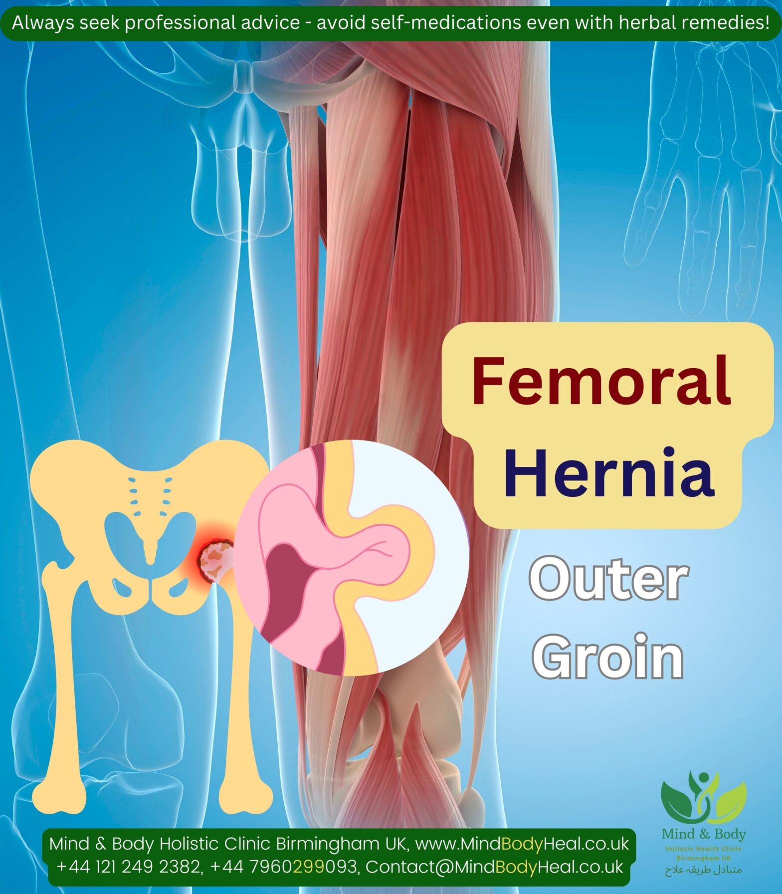Femoral Hernia – Suggested complimentary remedies – Mind & Body ...